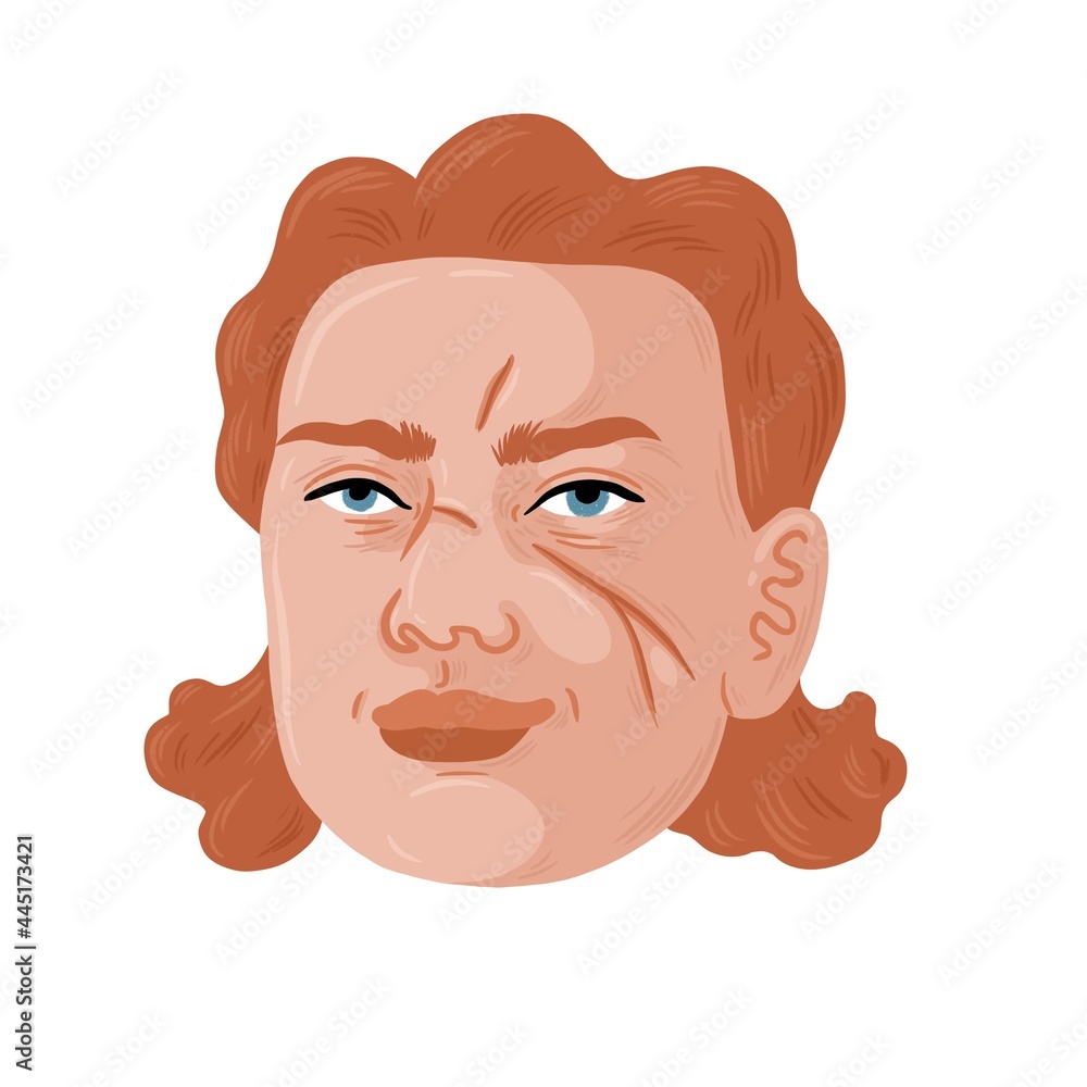 Man with white skin and light brown hair. He has a scar across his face ...