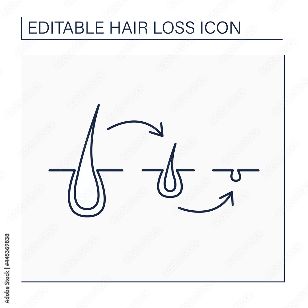 Hair follicle line icon. Causes of hair loss in men and woman ...