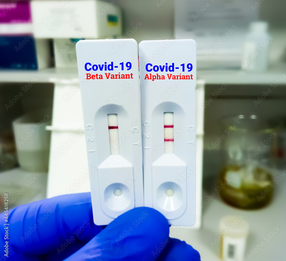 Scientist hold rapid test cassettes for Covid-19 variant testing with ...