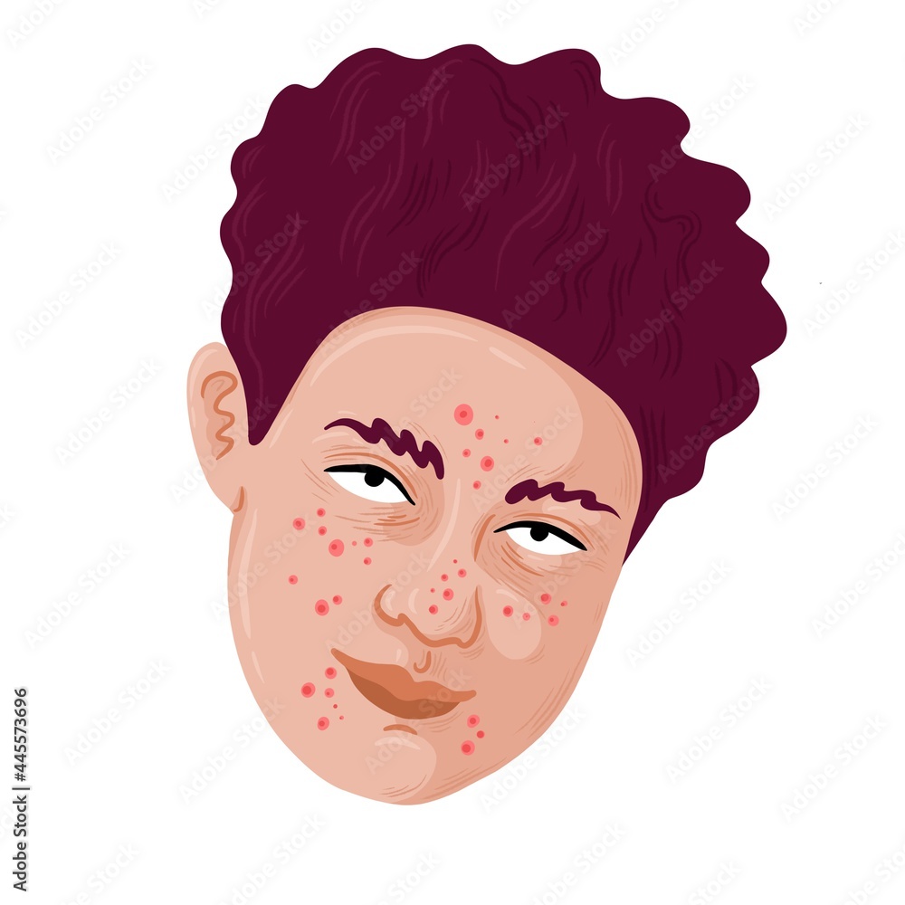 Nonbinary Person with white skin and purple hair. They have a lot of ...