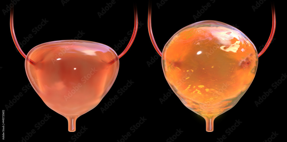 Urinary bladder empty and full, 3D illustration Stock Illustration ...