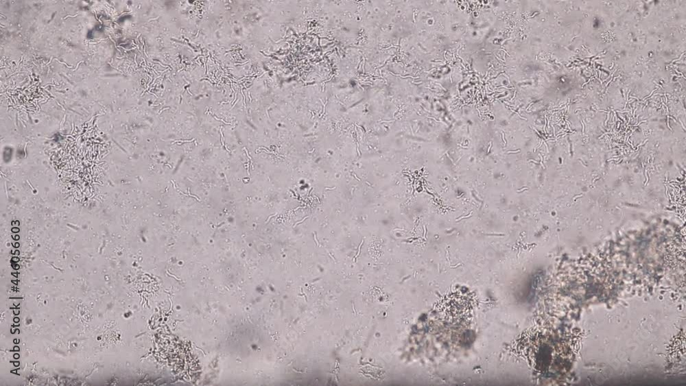 Bacteria and Protozoa in waste water under the microscope. Stock Video ...