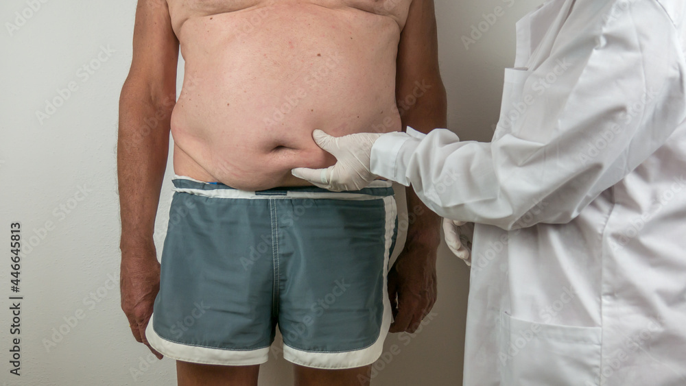 surgeon doing a medical checkup by palpating the belly on adipose ...