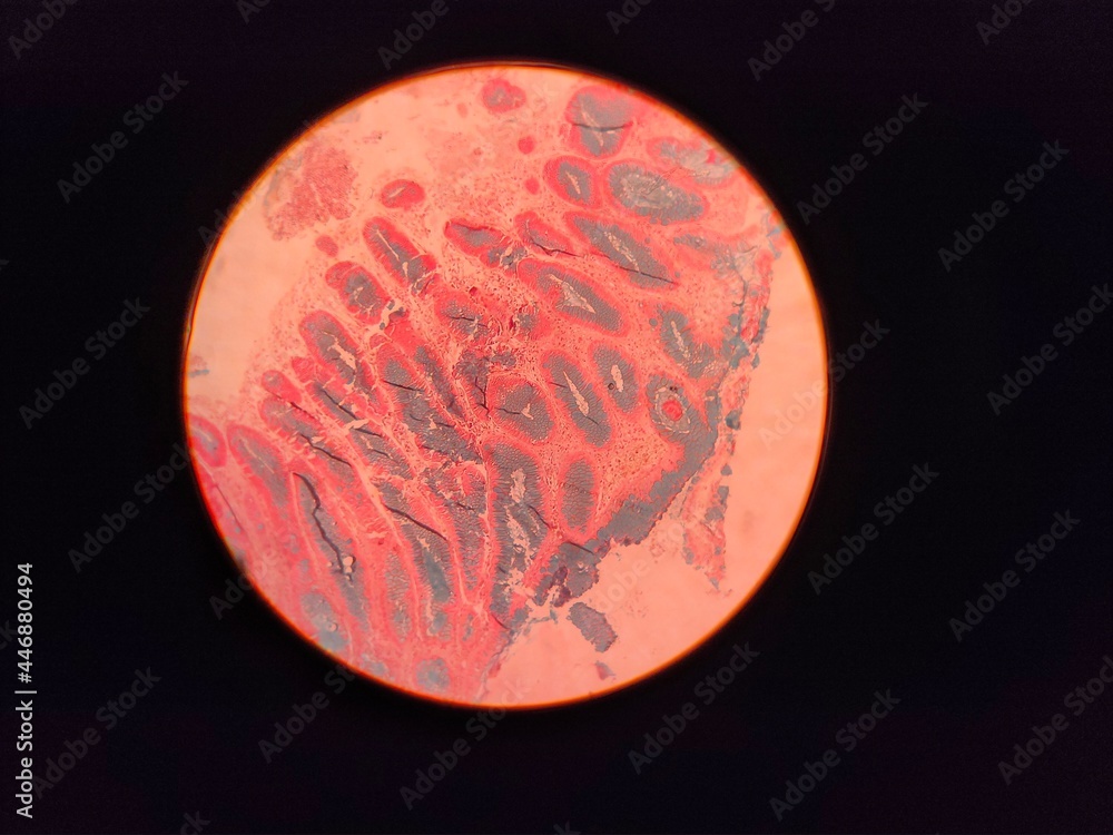 microscopic image of a human tissue stain slide. histology stain. Stock ...