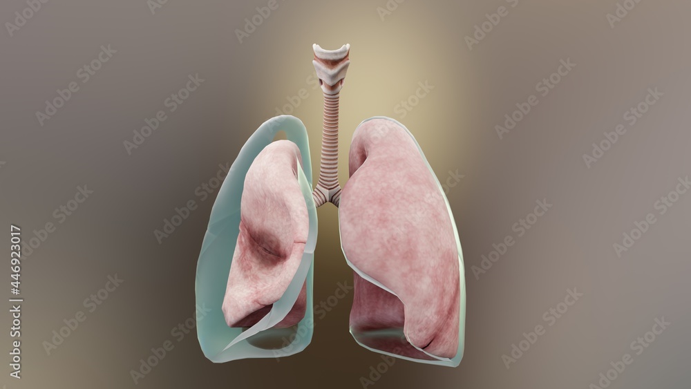 3d Illustration of Pneumothorax, Normal lung versus collapsed, symptoms ...