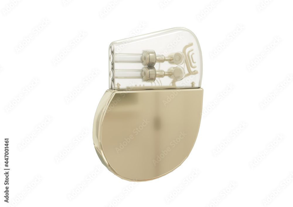 artificial cardiac pacemaker isolated on white background Stock Photo ...