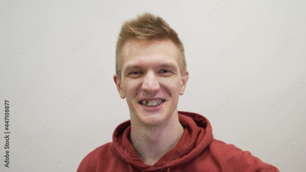 Young toothless man smiles. He opens his mouth and you can see braces ...