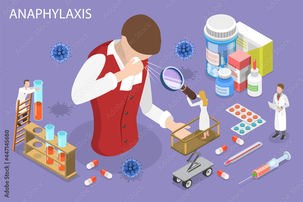 3D Isometric Flat Vector Conceptual Illustration of Anaphylaxis ...