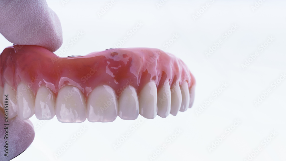 Beautiful dental prosthesis with high pink gums on a white background ...
