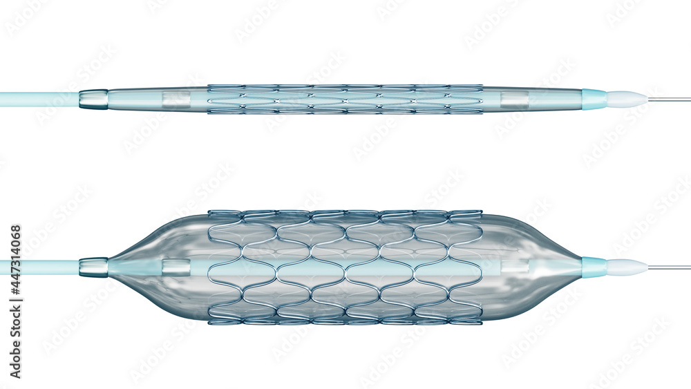 Deployed and collapsed stent ready for angioplasty isolated on white ...