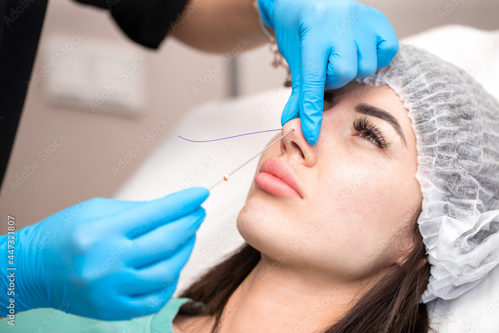 Cosmetic procedure for non-surgical rhinoplasty. The beautician inserts ...