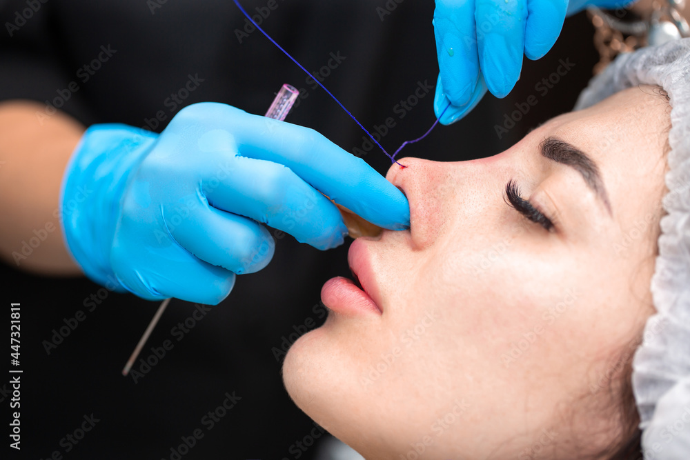 Cosmetic procedure for non-surgical rhinoplasty. The beautician inserts ...