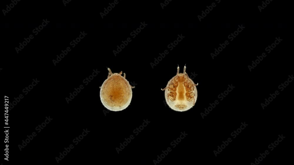 Soil mite of the family Uropodidae under a microscope, order ...