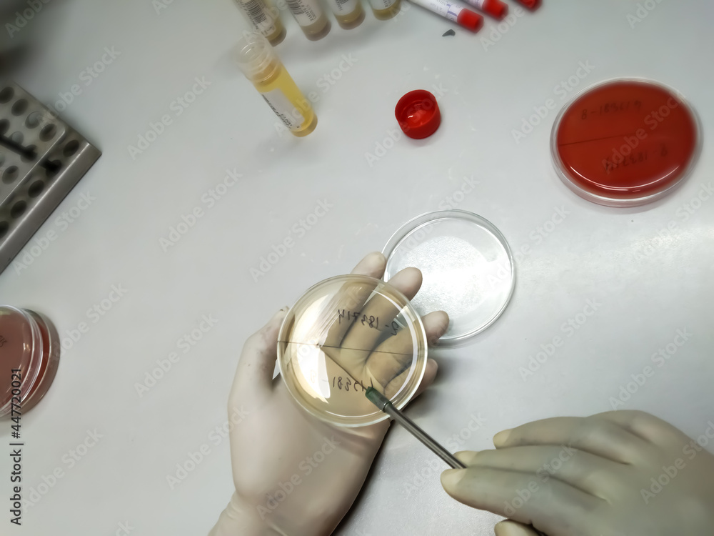 Scientist or microbiologist inoculate urine specimen with Platinum loop ...