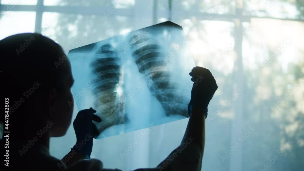 Studying X-ray image of human chest on window background, doctor ...