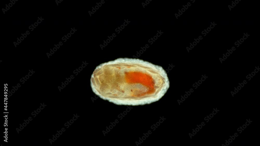 Pentacula Holothuroidea larva, Juvenile sea cucumber under microscope ...