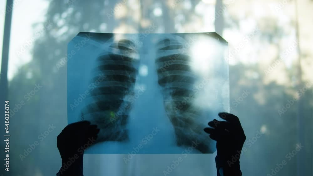 Holding X-ray image of human chest on window background, doctor ...