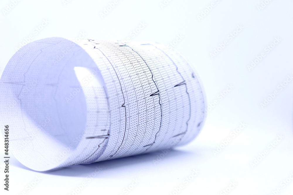 Ekg paper showing ECG results, white background. Stock Photo | Adobe Stock