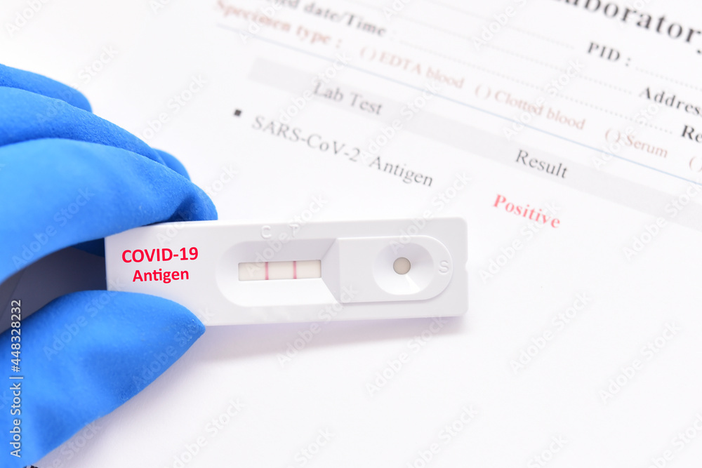 COVID-19 positive test result by using COVID-19 antigen test kit, rapid ...