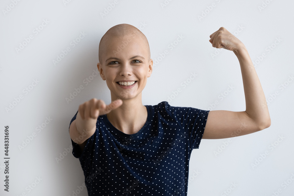 Cheerful young hairless after chemotherapy ill woman pointing finger at ...