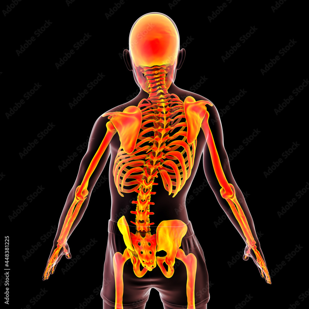 Scoliosis, 3D illustration. Spine curve anatomy Stock Illustration ...