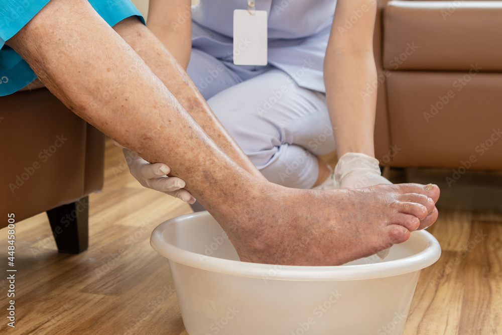 A female nurse is washing the feet of an old man for treatment ...