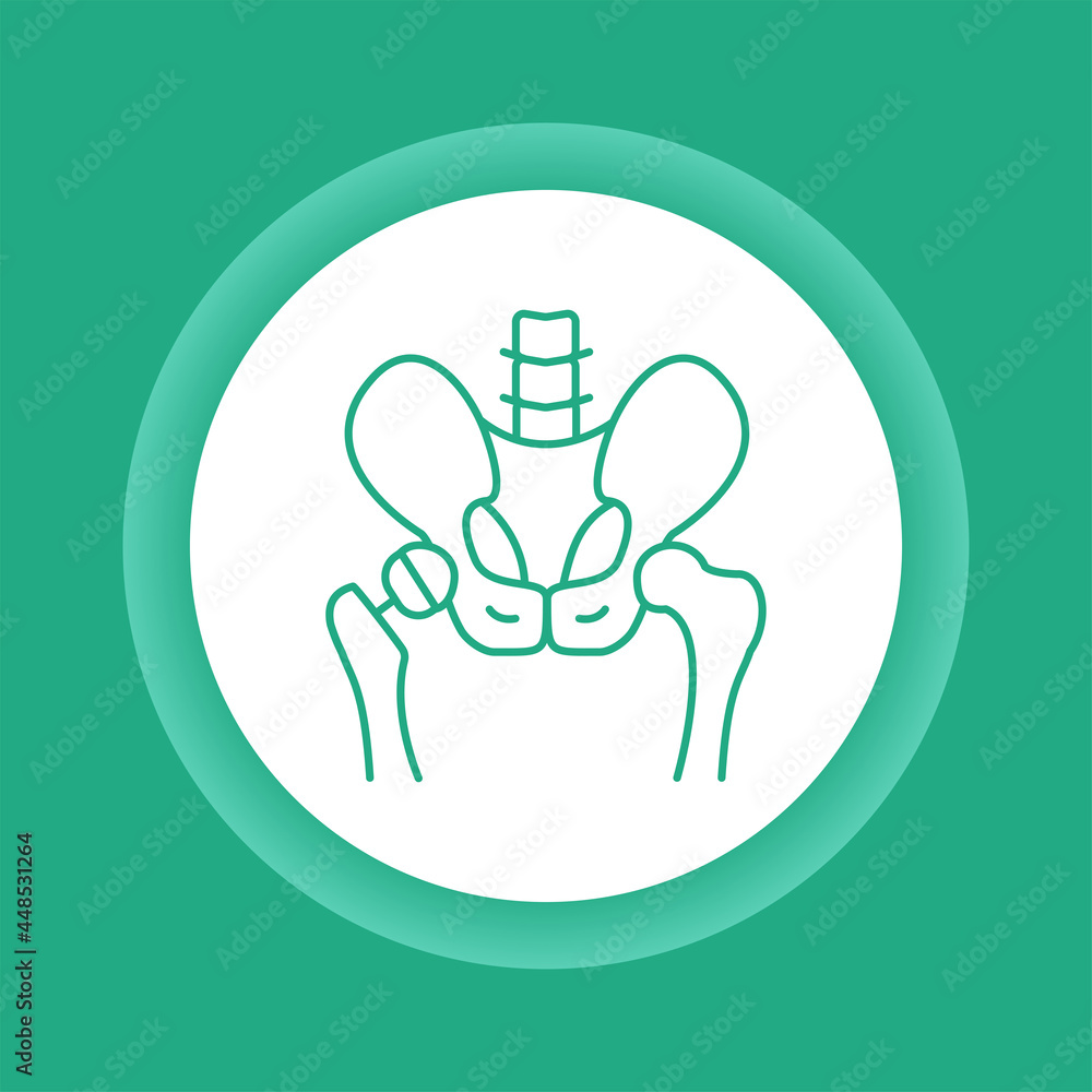 Arthroplasty color button icon. Hip replacement implant Stock Vector ...