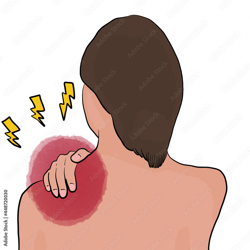 scapular pain and shoulder pain on white background Stock Illustration ...