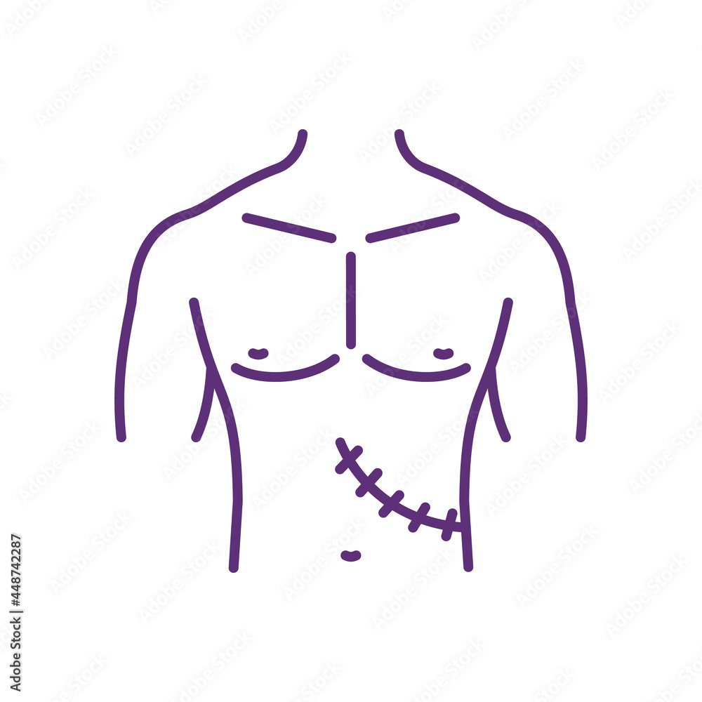 Removed organ aftermath RGB color icon. Surgery recovery. Illicit organ ...