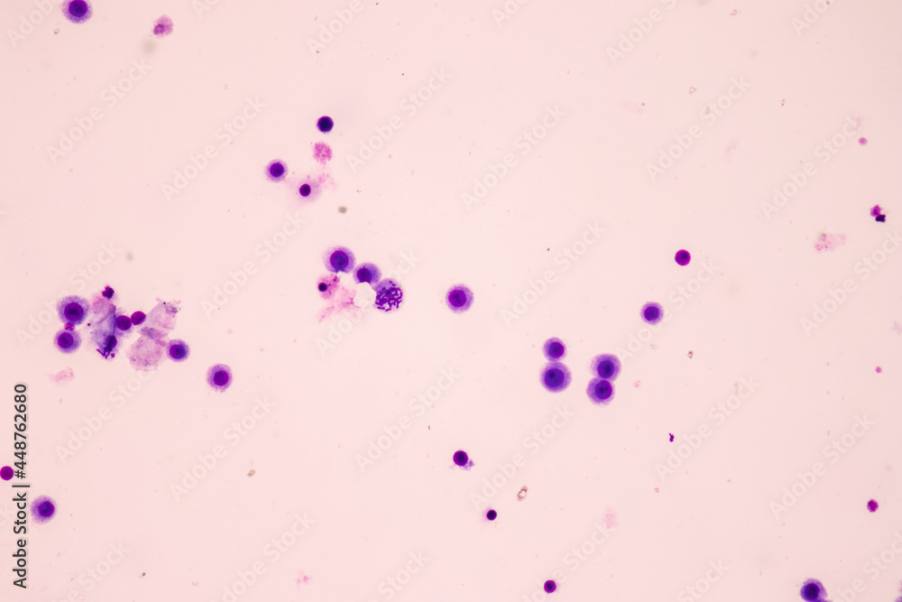 Chromosomes Human under the microscope for education. Stock Photo ...