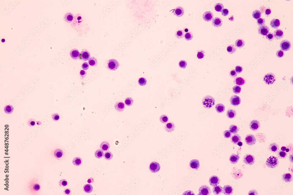 Chromosomes Human under the microscope for education. Stock Photo ...