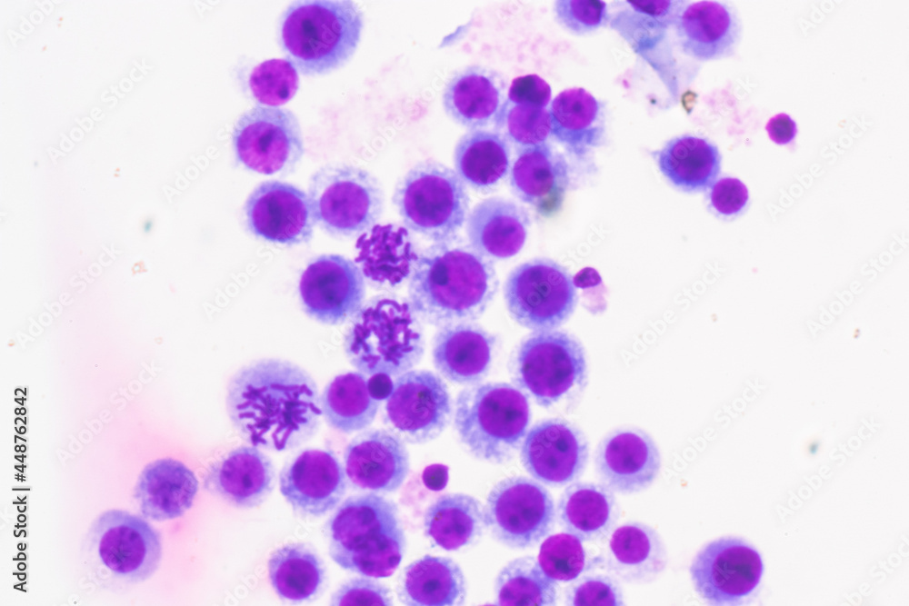 Chromosomes Human under the microscope for education. Stock Photo ...