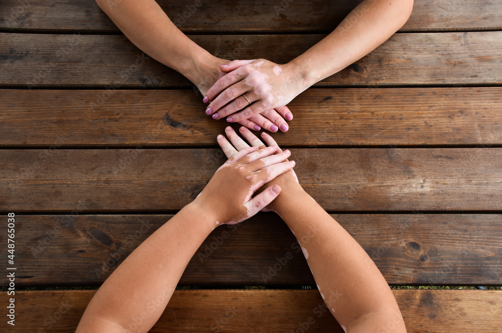 Two People Mom And Daughter Holding Hands Together Against Each Other