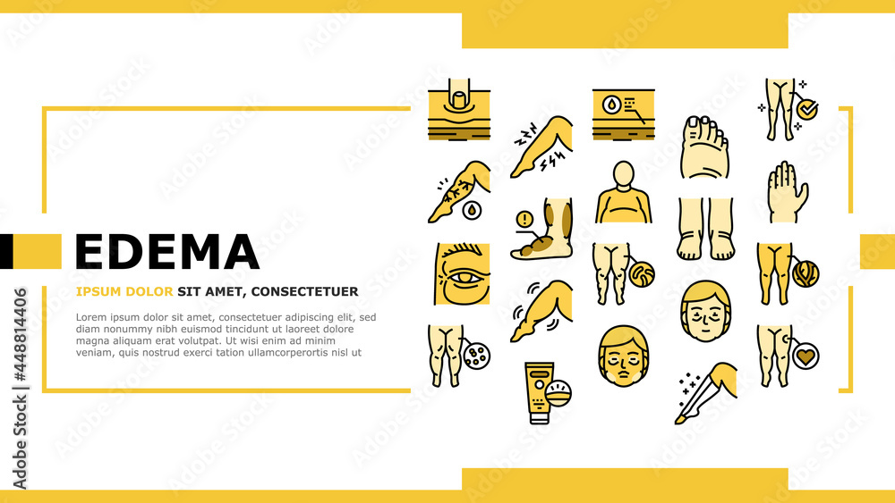 Edema Disease Symptom Landing Web Page Header Banner Template Vector ...