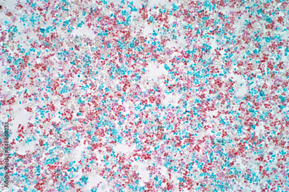 Saccharomyces cerevisiae yeast budding cell under the light microscope ...