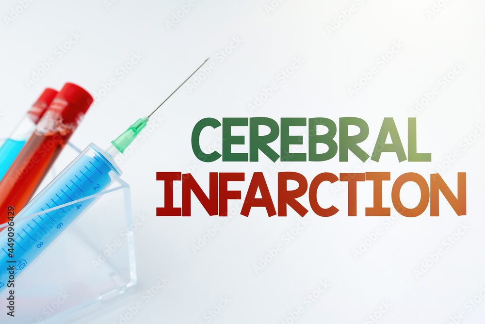 Hand writing sign Cerebral Infarction. Concept meaning focal brain ...