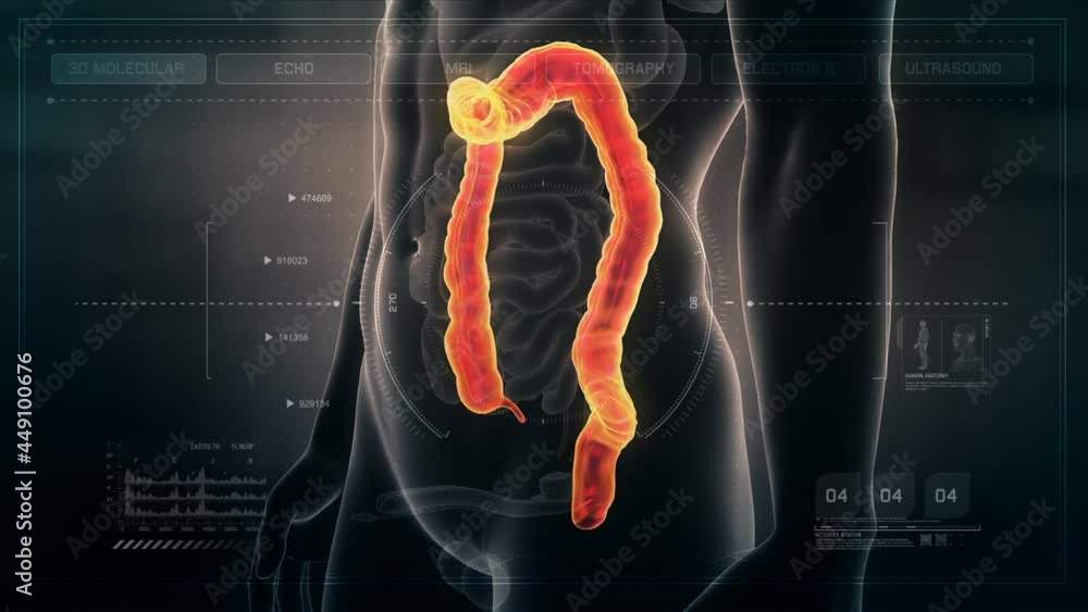 Anatomy of Human Male Colon on Futuristic Medical Interface dashboard ...