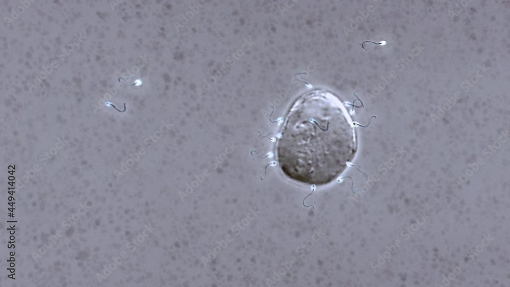 Vidéo Stock Sperm Cells Under Microscope At Research Laboratory. Sperm ...