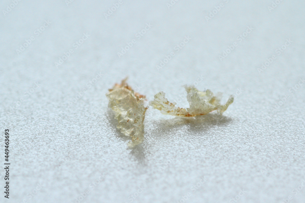 Dandruff is a common scalp condition in which small pieces of dry skin ...