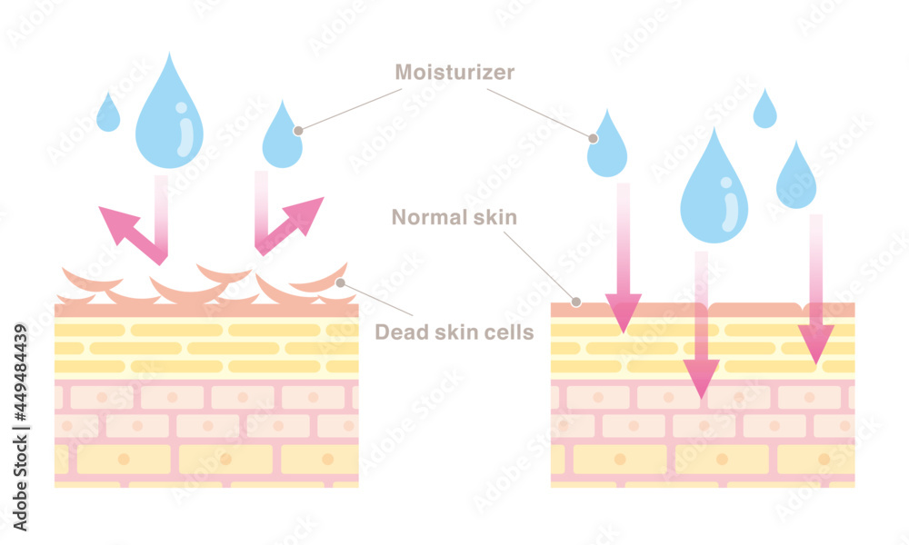 Skin cross section. Moisturizer will not penetrate skin of dead skin ...
