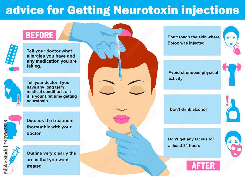 Advice for getting neurotoxin injections. Infographics. Vector ...