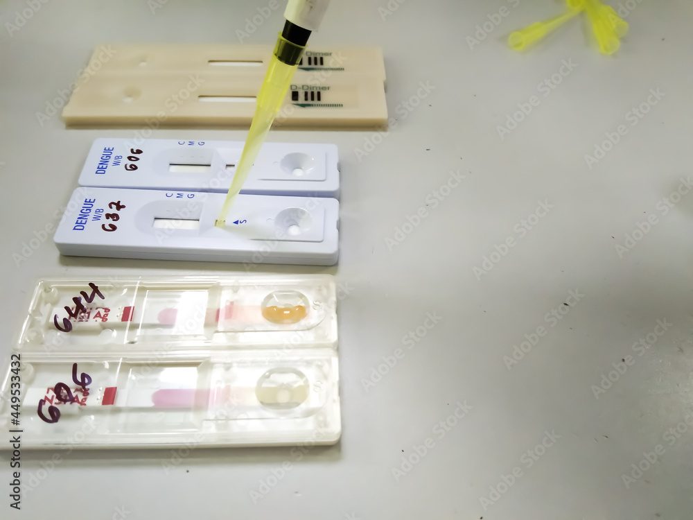 Fototapeta Rapid test cassettes for Dengue Antigen NS1Ag test at ... Fototapeta Rapid test cassettes for Dengue Antigen NS1Ag test at ...