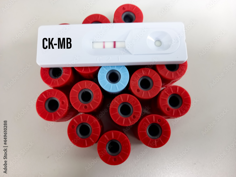 CK MB testing by using rapid test cassette, the result showed positive ...