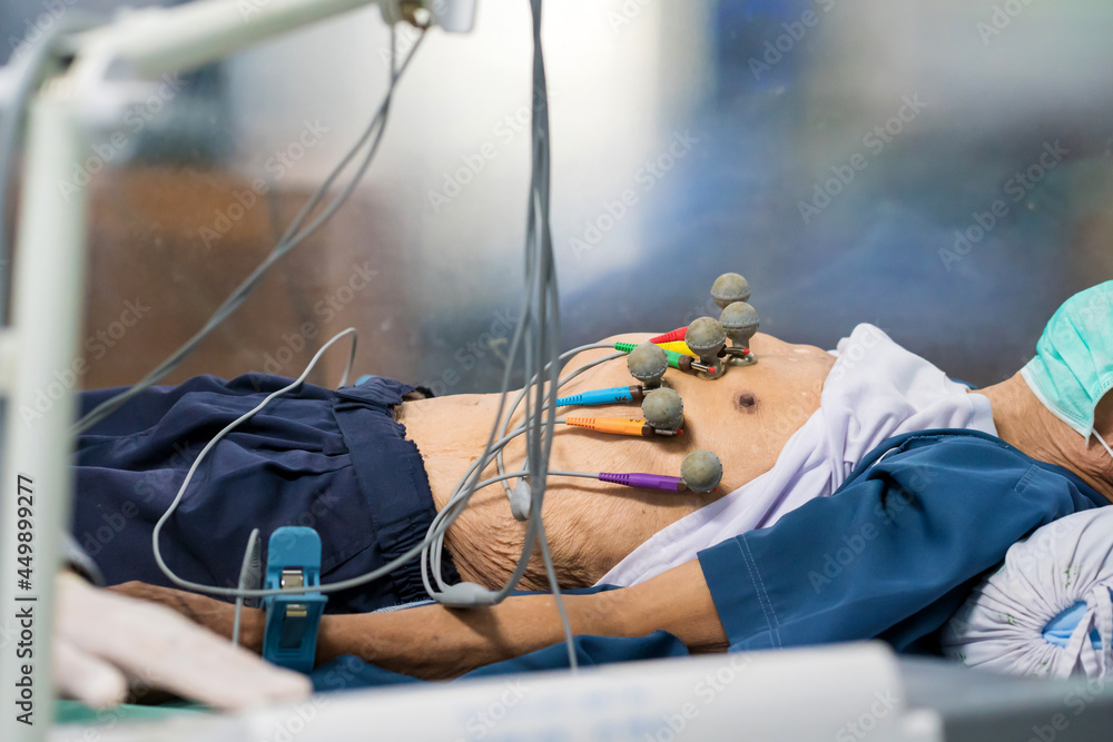 ECG or EKG of man with electrodes for electrocardiogram records on bed ...