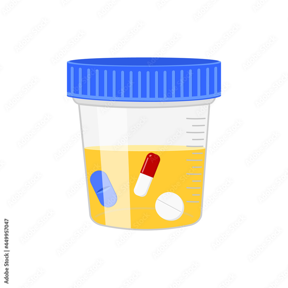 Urine sample with floating pills. Positive drug test result. Doping ...