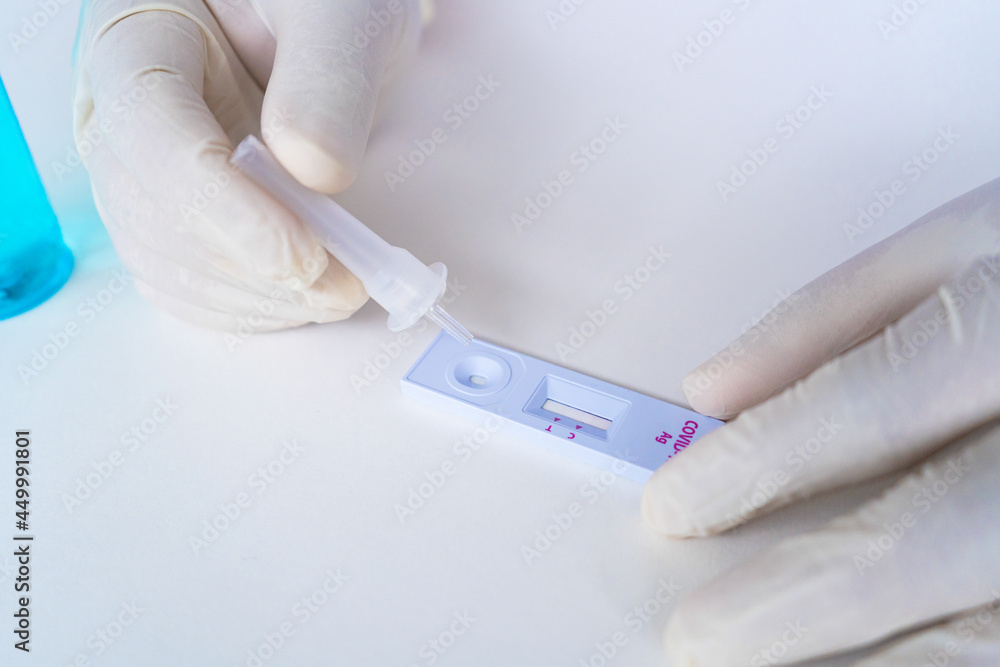 COVID-19 quick Rapid Diagnostic Test RDT, medical worker place ...