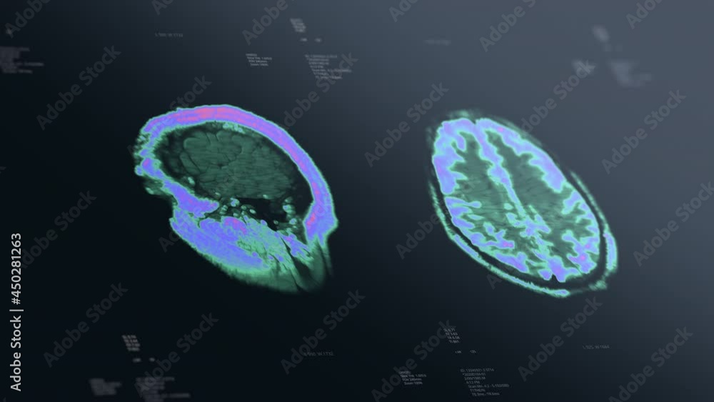 Brain scan visualization animation. Diagnosis data on laboratory ...