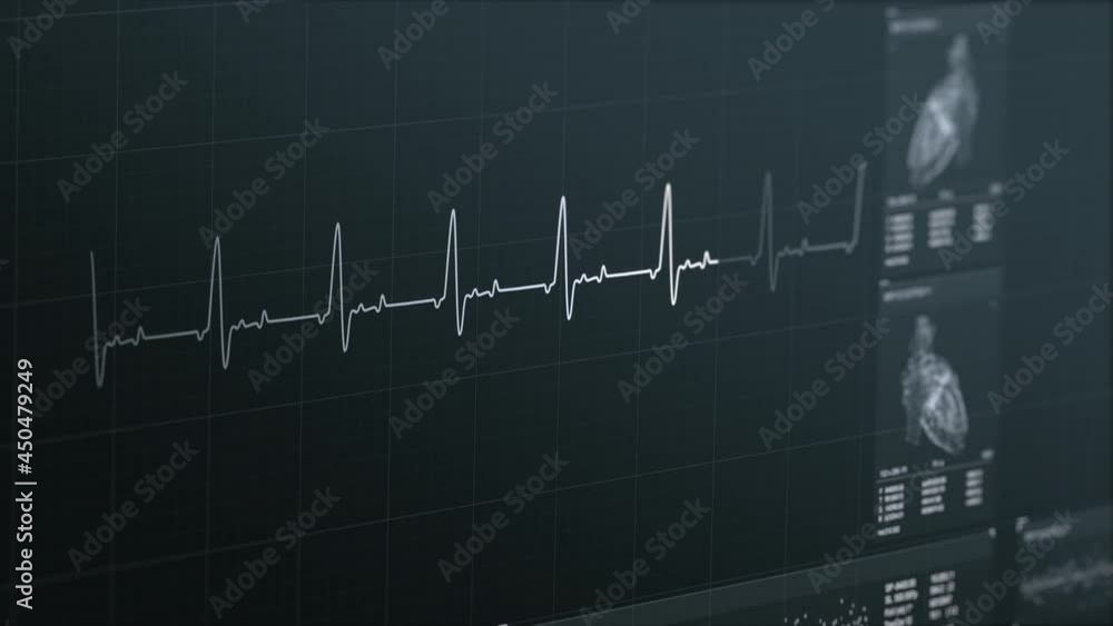 Dynamic heart rate or heart beat line. Cardiogram signal monitoring ...