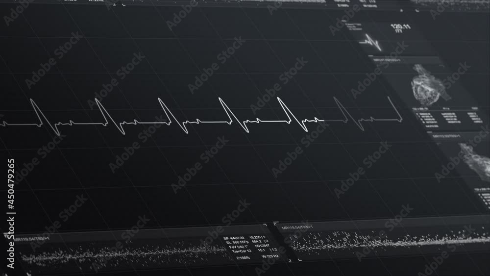 Video „Dynamic heart rate or heart beat line. Cardiogram signal ...