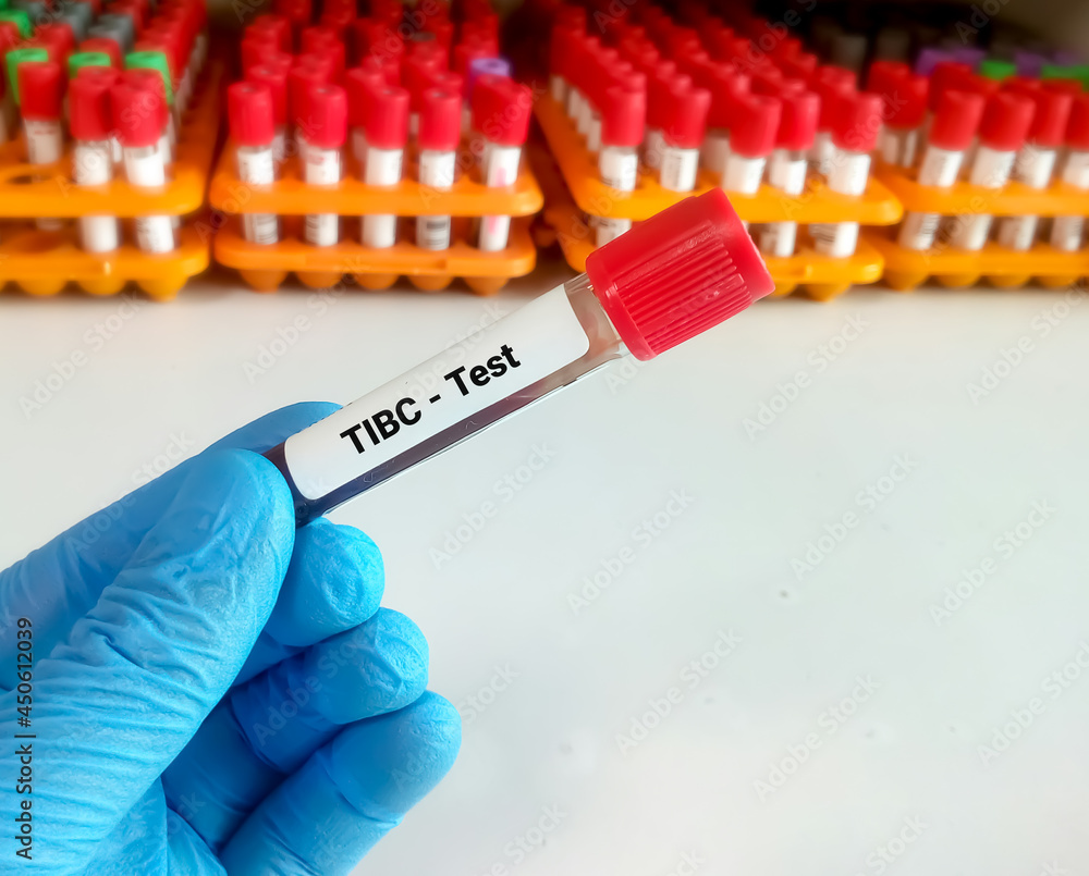 Blood sample for Total Iron Binding Capacity (TIBC) test. Iron ...
